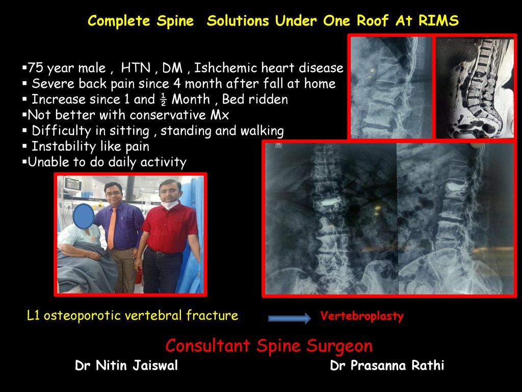 Vertebroplasty - Shreshth Spine Care